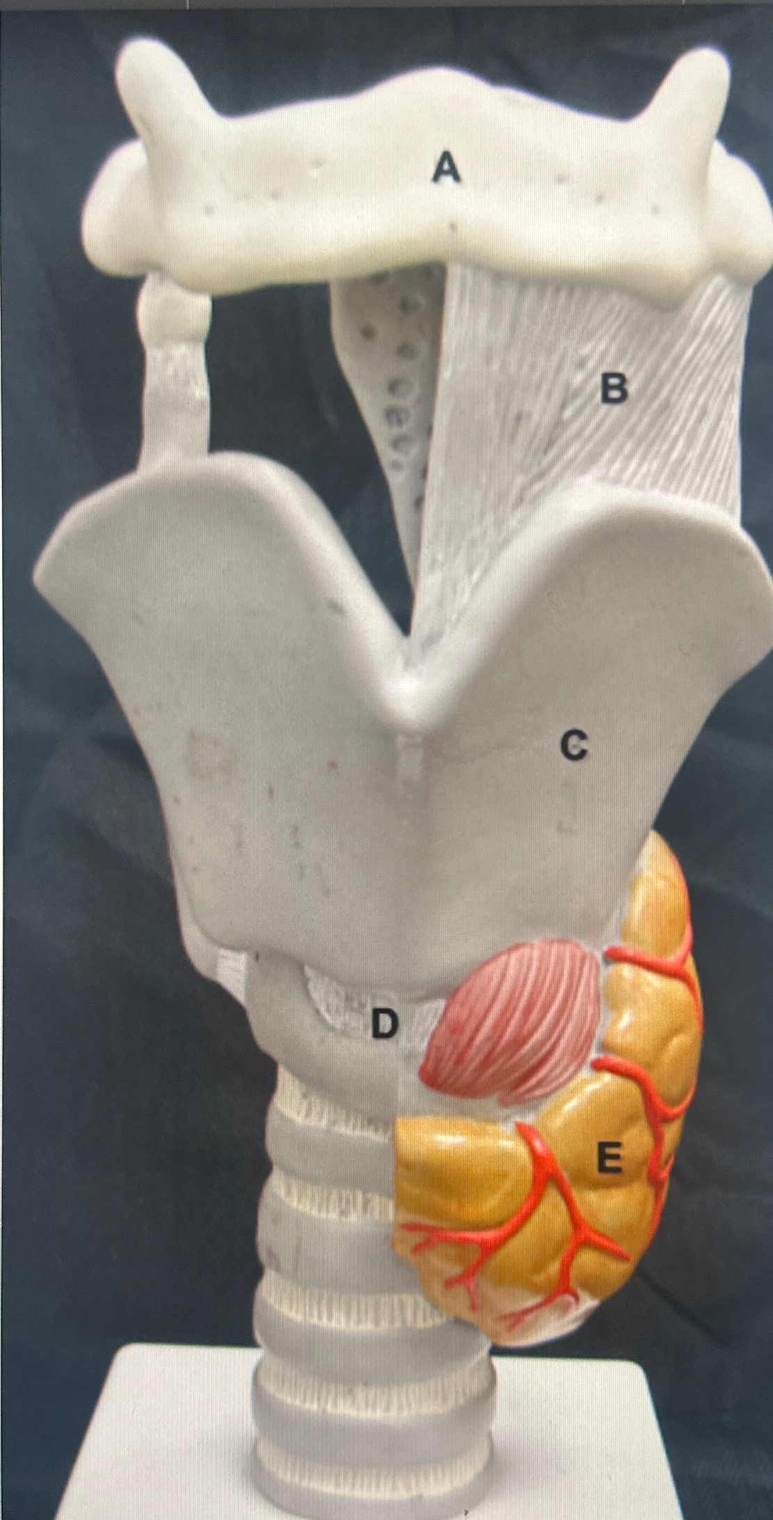 Solved The structure labeled D is a ligament named after the | Chegg.com