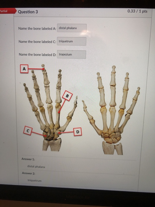 Solved Partial Question 3 0.33/1 pts Name the bone labeled | Chegg.com