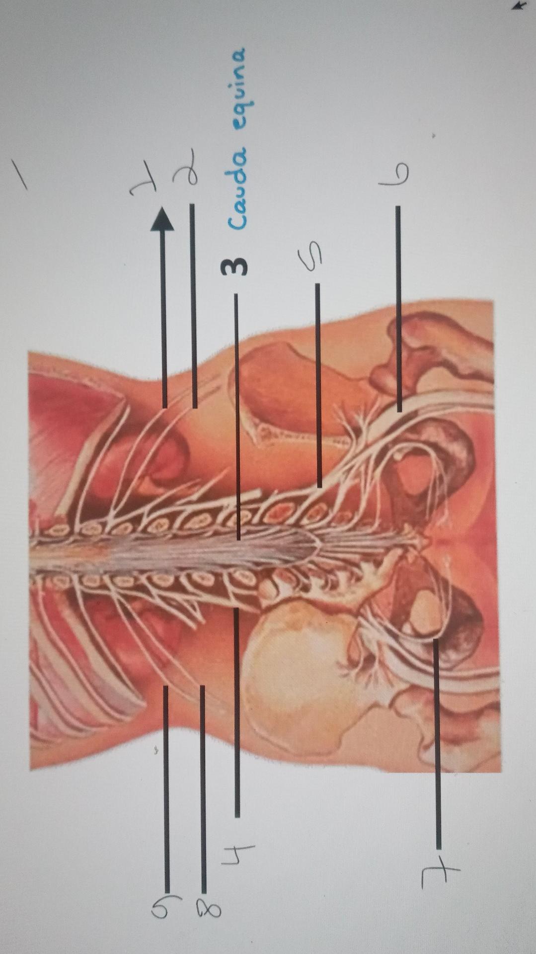 Solved Please label the structures pointed by all the black | Chegg.com