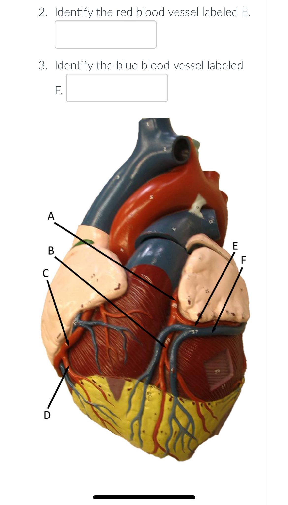 Solved Identify the red blood vessel labeled E.Identify the | Chegg.com