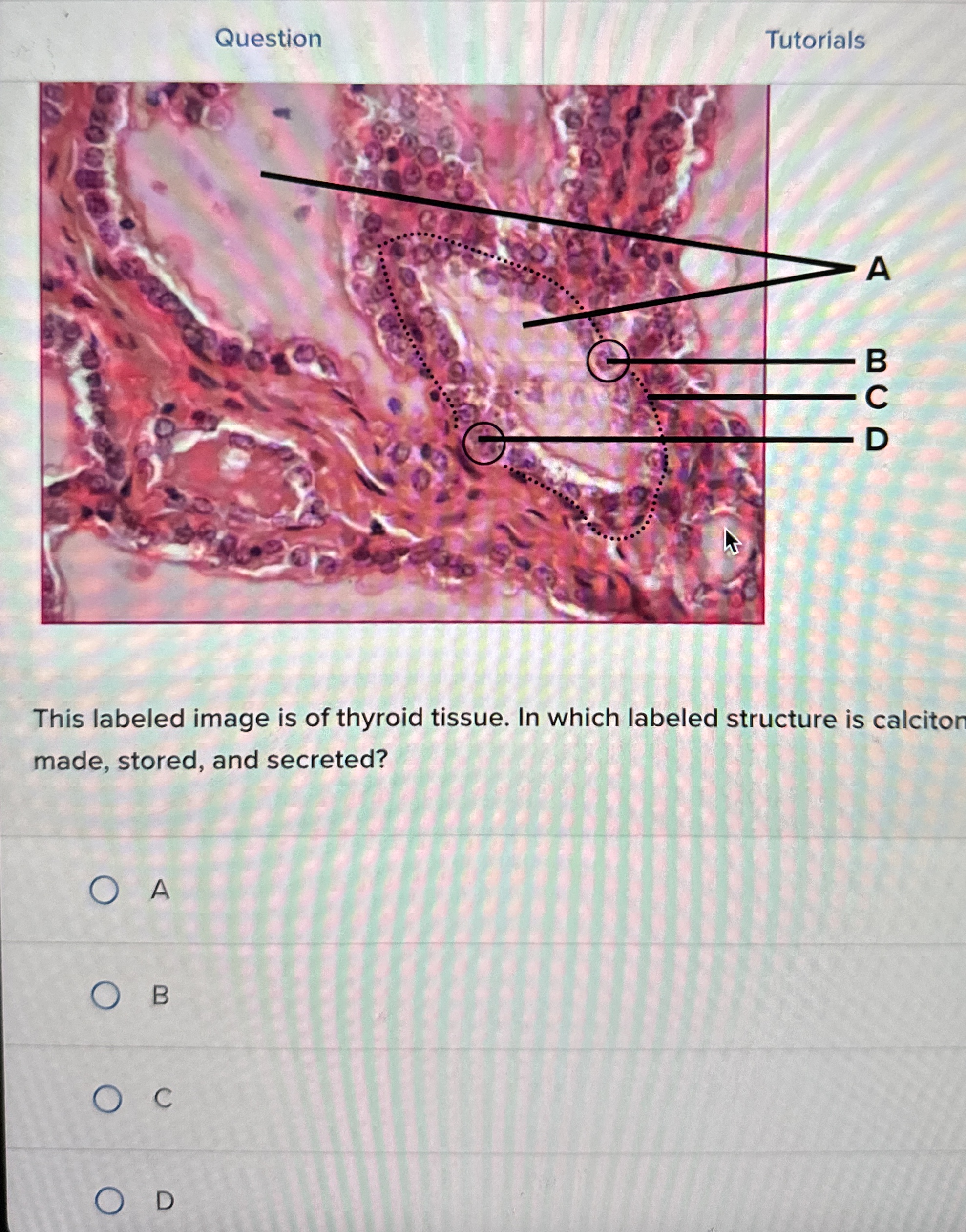 Solved QuestionTutorialsThis labeled image is of thyroid | Chegg.com