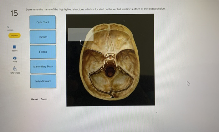 Solved Determine the name of the highlighted structure, | Chegg.com