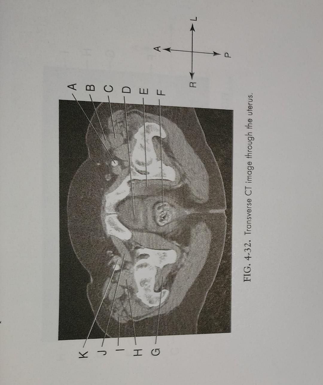 Solved FIG. 4-32. Transverse CT image through the | Chegg.com