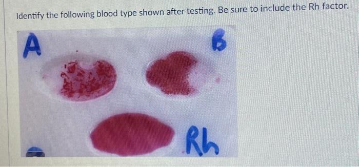 Solved Identify the following blood type shown after | Chegg.com