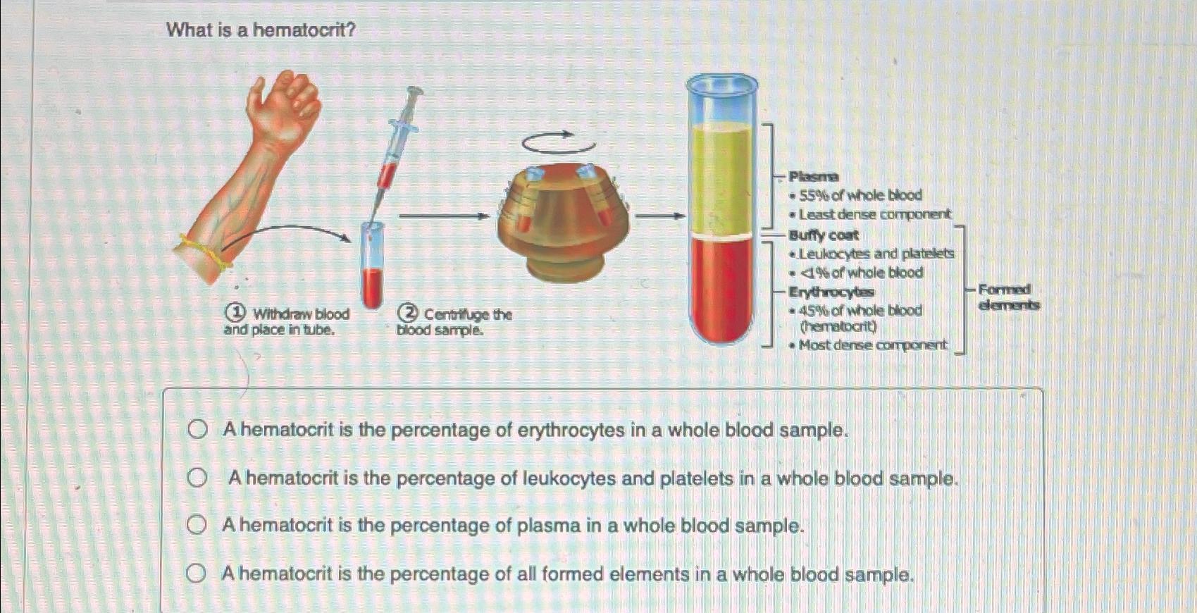 Solved What is a hematocrit?(1) ﻿Whindraw blood and place in | Chegg.com