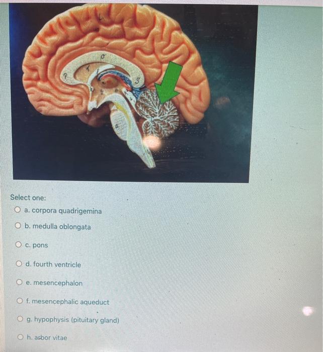 Corpora Quadrigemina