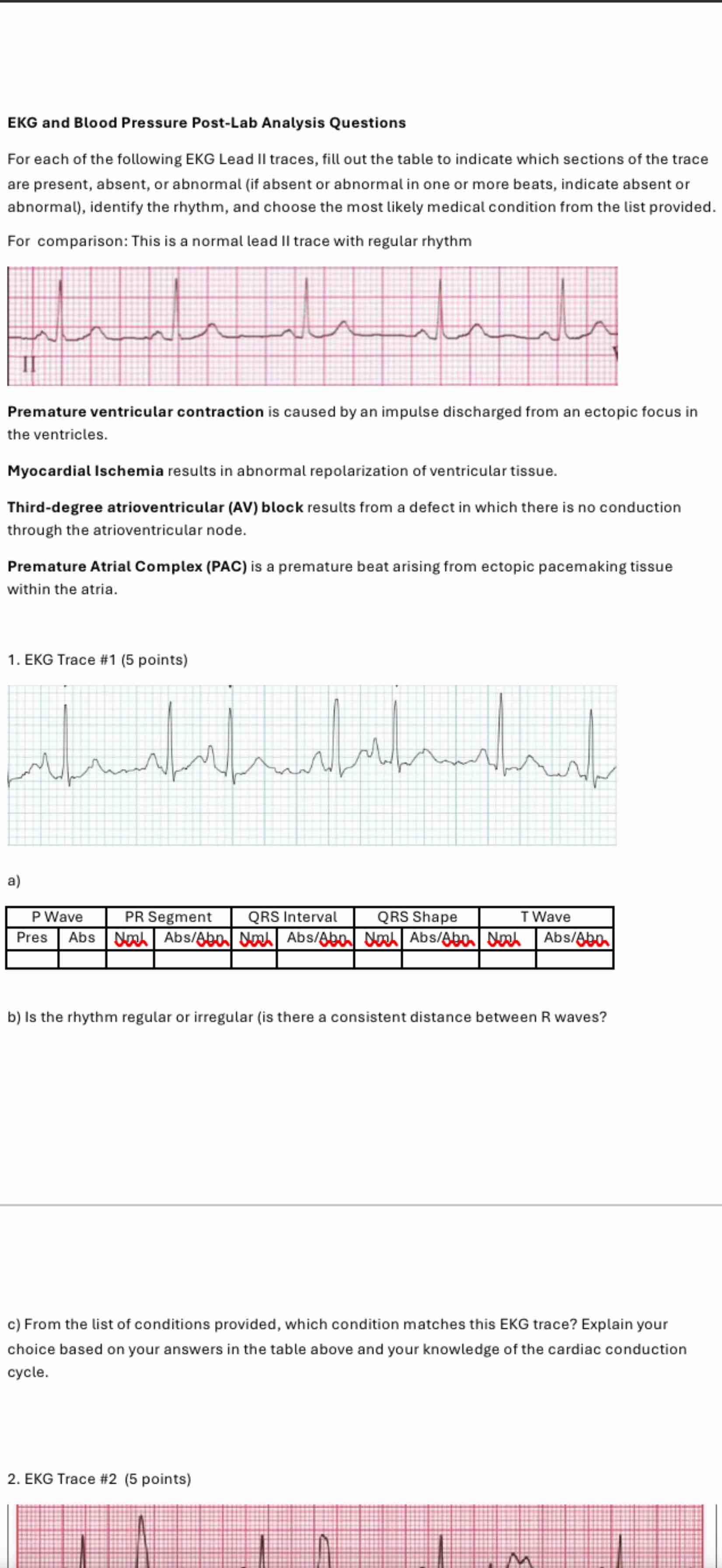 Solved EKG and Blood Pressure Post-Lab Analysis QuestionsFor | Chegg.com