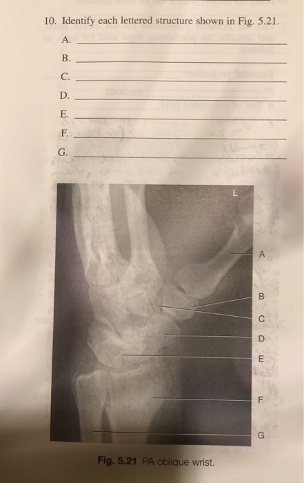 Solved 10. Identify each lettered structure shown in Fig. | Chegg.com