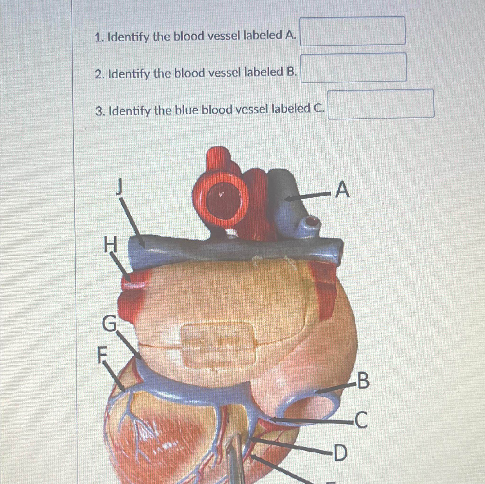 Solved Identify the blood vessel labeled A.Identify the | Chegg.com