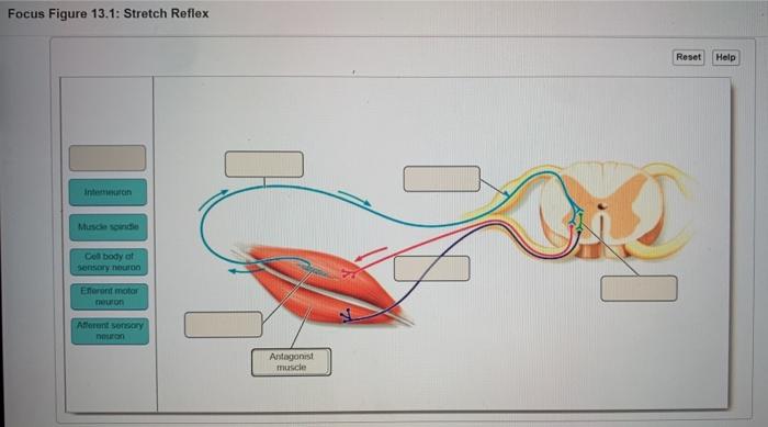 Solved Focus Figure 13.1: Stretch Reflex Reset Help i Murde | Chegg.com