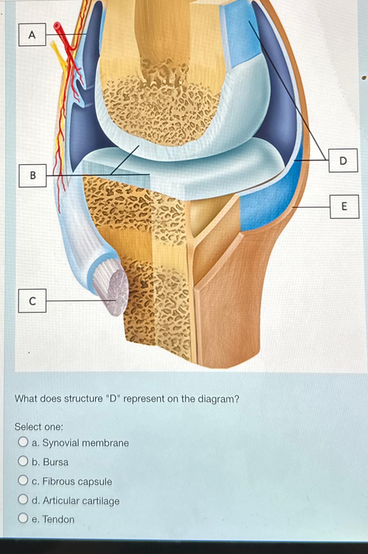 Solved What does structure "D" ﻿represent on the | Chegg.com