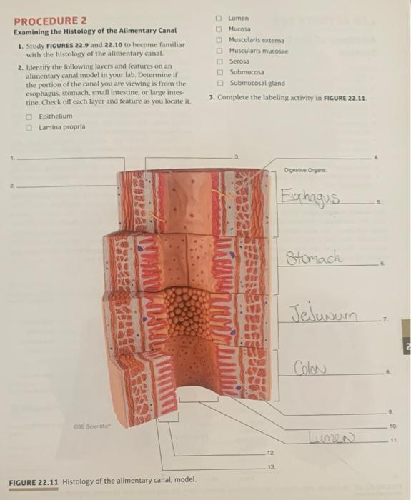 PROCEDURE 2 Examining the Histology of the Alimentary | Chegg.com