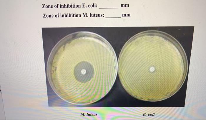 Solved 1.) Measure and record the Zone of Inhibition (in | Chegg.com