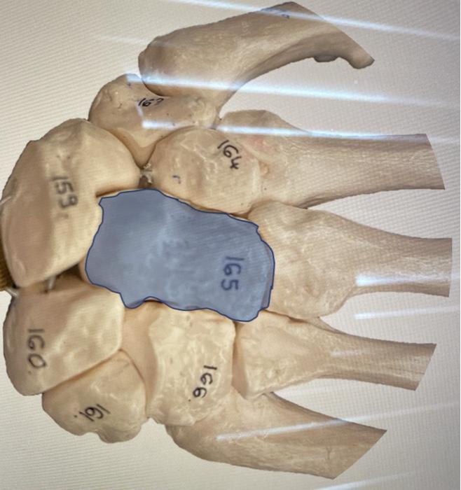 Solved Lunate Capitate Scaphoid Trapezoid Trapezium | Chegg.com