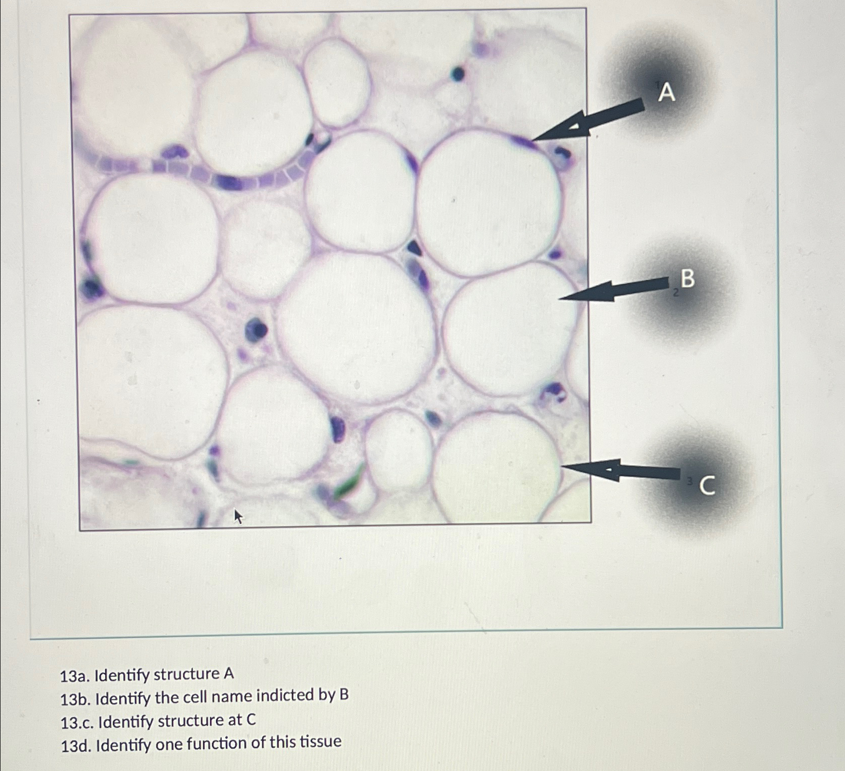 Solved 13a. ﻿Identify structure A13b. ﻿Identify the cell | Chegg.com