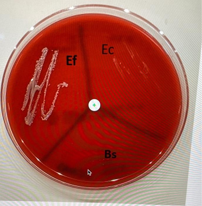 Solved UR A. TSA-blood Plate and CNA-blood Plate Hemolysis | Chegg.com