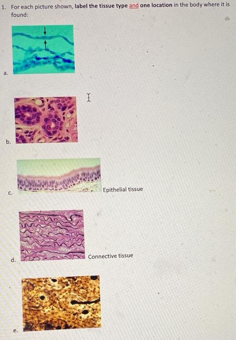 Solved 1. For each picture shown, label the tissue type and | Chegg.com