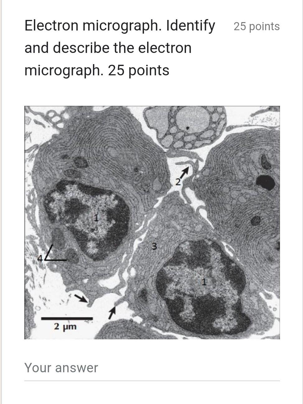 Solved Electron micrograph. Identify 25 points and describe | Chegg.com