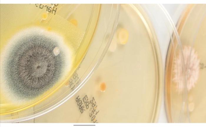Solved Refer to the colony morphology chart and describe one | Chegg.com