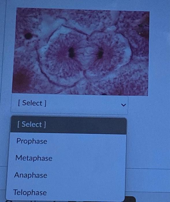 Solved [ Select ] [ Select ] Prophase Metaphase Anaphase | Chegg.com