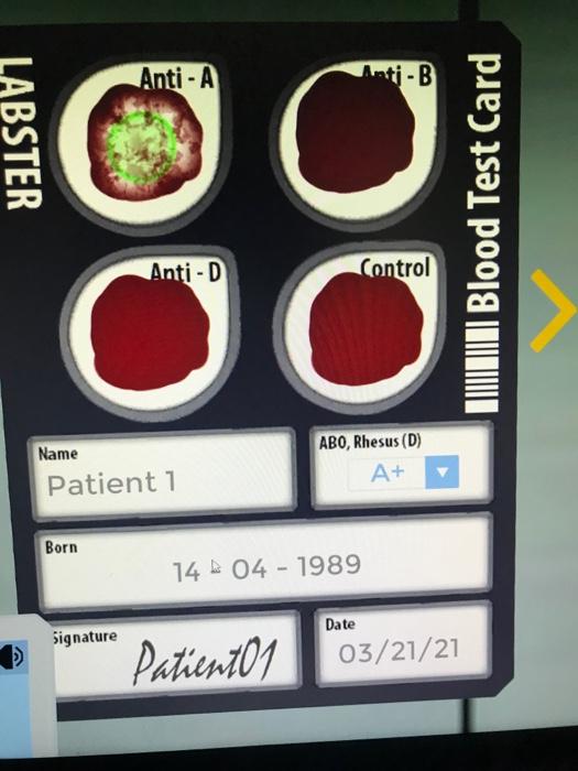 Solved Anti-A LABSTER C C 00 ||||| Blood Test Card Anti-D | Chegg.com