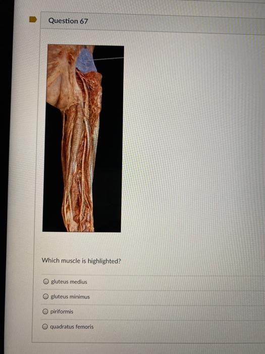 Solved Question 67 Which muscle is highlighted? gluteus | Chegg.com
