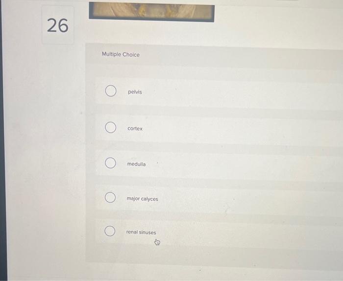 Solved Which structure is highlighted? Multiple Choice | Chegg.com