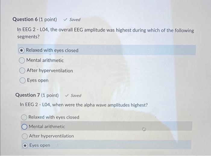 Solved Match the EEG wave to the activity during which you | Chegg.com