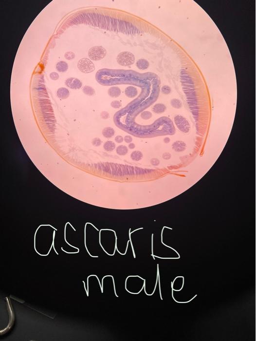Solved Label 3 germ layers in ascaris male & female- | Chegg.com