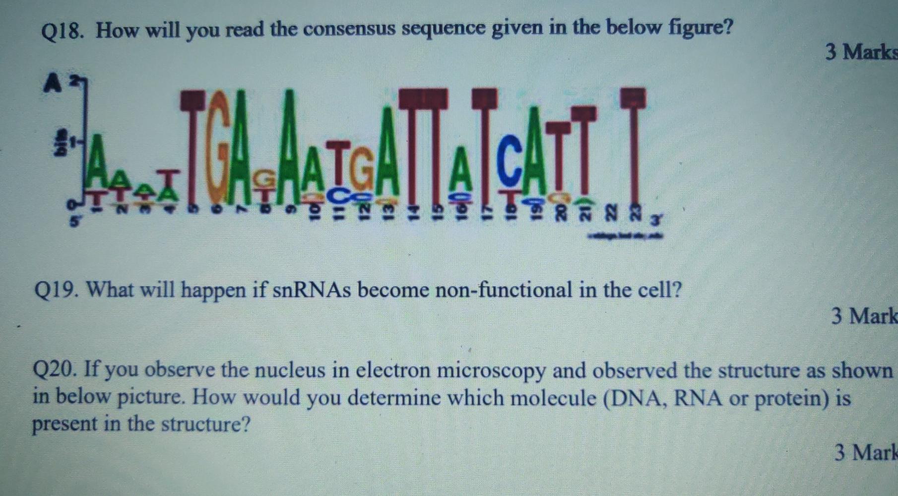 Solved Q18. How will you read the consensus sequence given | Chegg.com