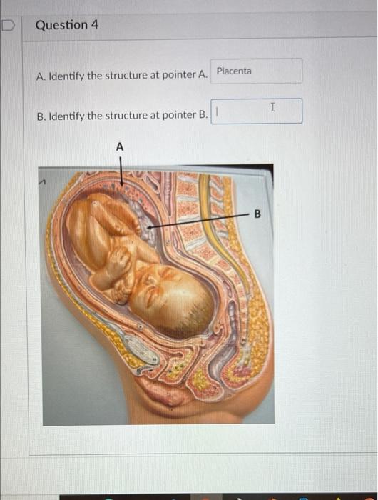 Solved D Question 4 A. Identify the structure at pointer A. | Chegg.com
