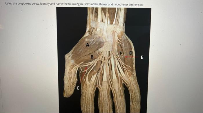Solved Using the dropboxes below, identify and name the | Chegg.com