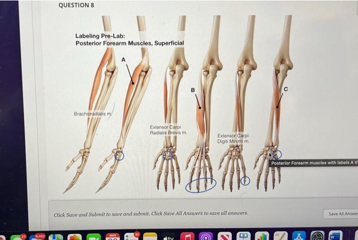 Solved QUESTION 8 Labeling Pre-Lab: Posterior Forearm | Chegg.com