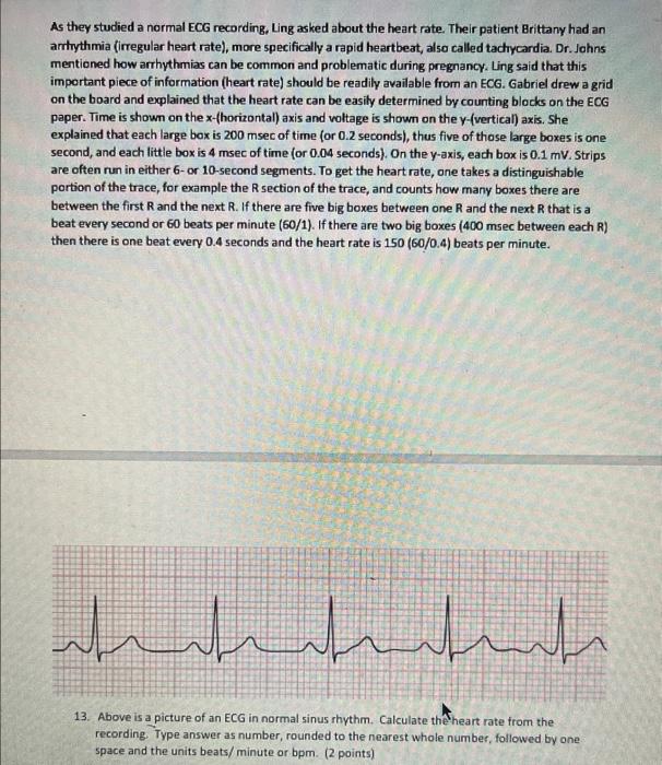 Solved As they studied a normal ECG recording, Ling asked | Chegg.com
