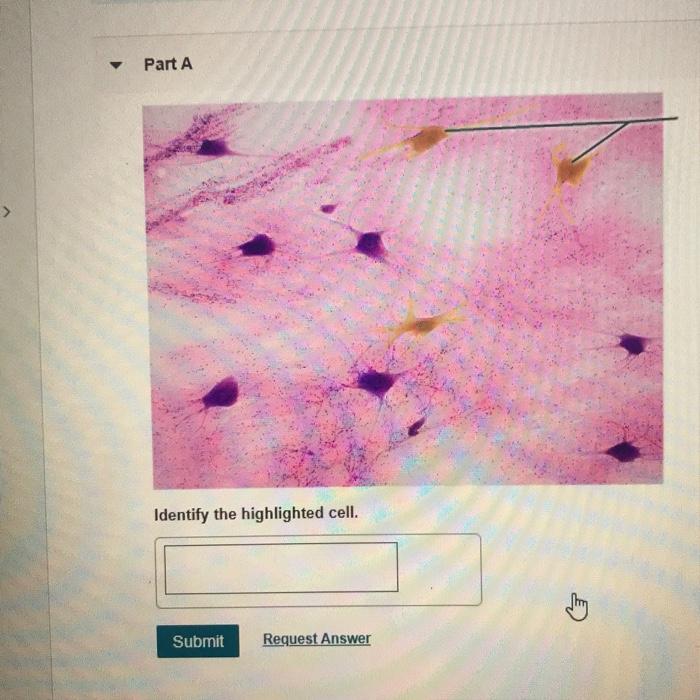 Solved Part A The GI tract has four distinct layers. Which | Chegg.com