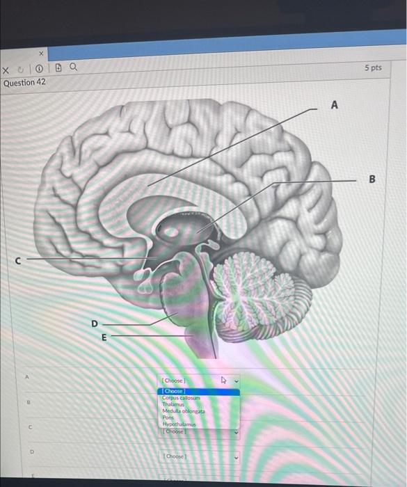 Solved brain | Chegg.com