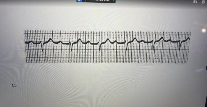 identify the QRS, QT, heart rate and PR, ST, and | Chegg.com
