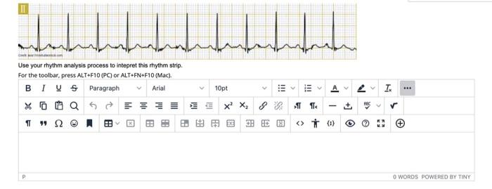 Solved Use your rhythm analysis process to intepret this | Chegg.com