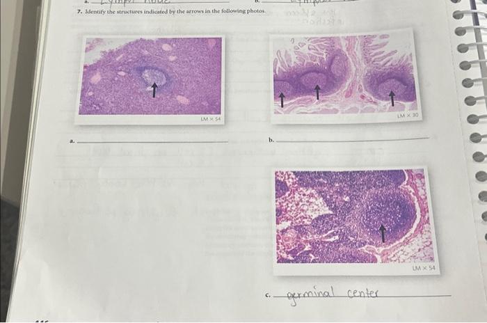 Solved MAC a. a. 7. Identify the structures indicated by the | Chegg.com