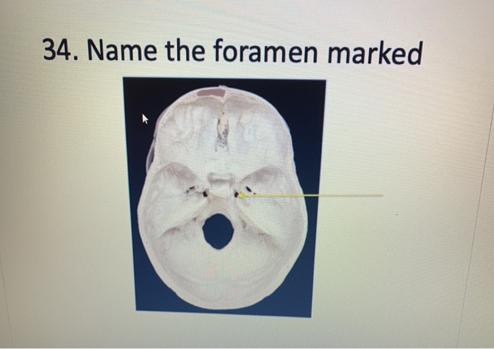 Solved 34. Name the foramen marked | Chegg.com