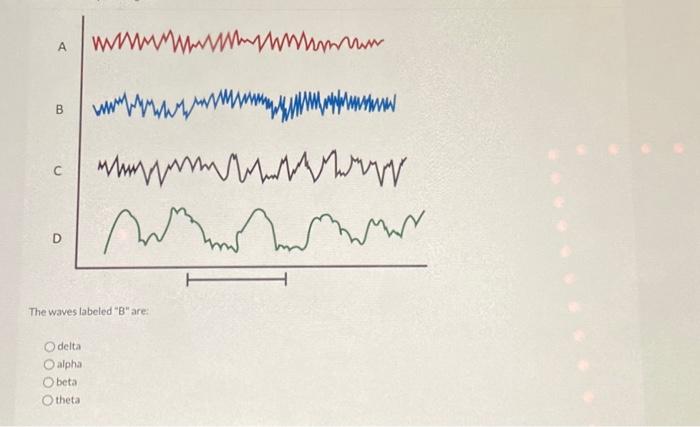 Solved The waves labeled " 8 " are: delta alpha beta theta | Chegg.com