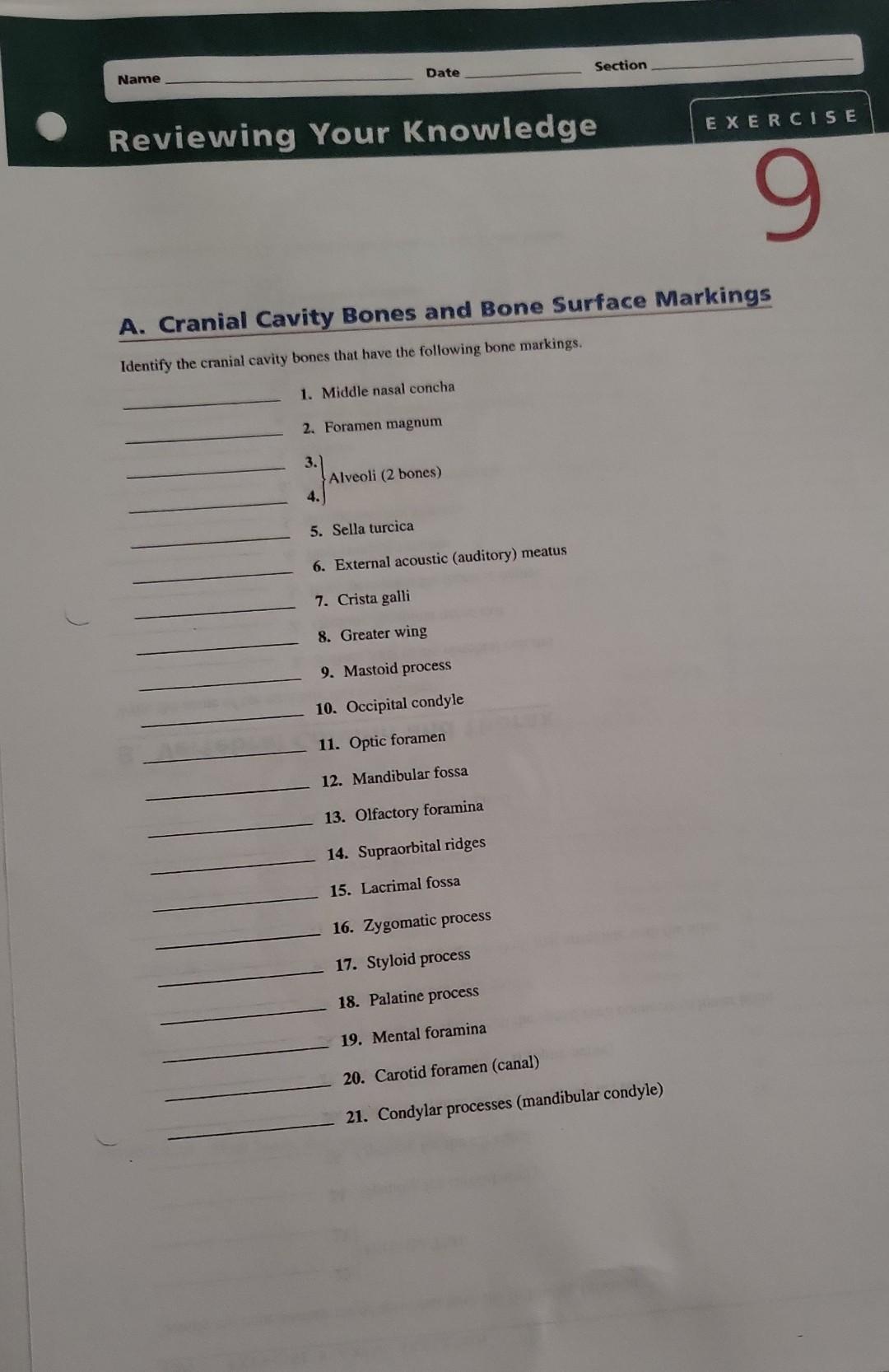 Solved A. Cranial Cavity Identify the cranial cavity bones | Chegg.com