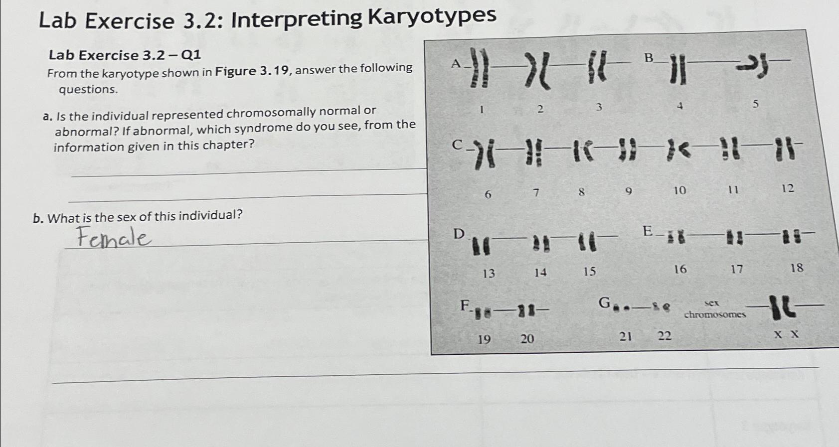 Solved Lab Exercise 3.2: Interpreting KaryotypesLab Exercise | Chegg.com Solved Lab Exercise 3.2: Interpreting KaryotypesLab Exercise | Chegg.com
