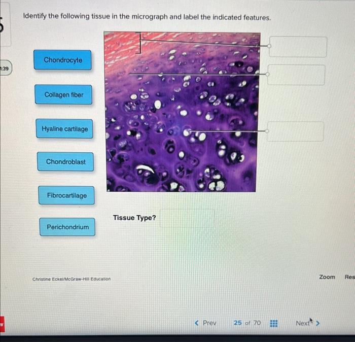 Solved Identify the following tissue in the micrograph and | Chegg.com
