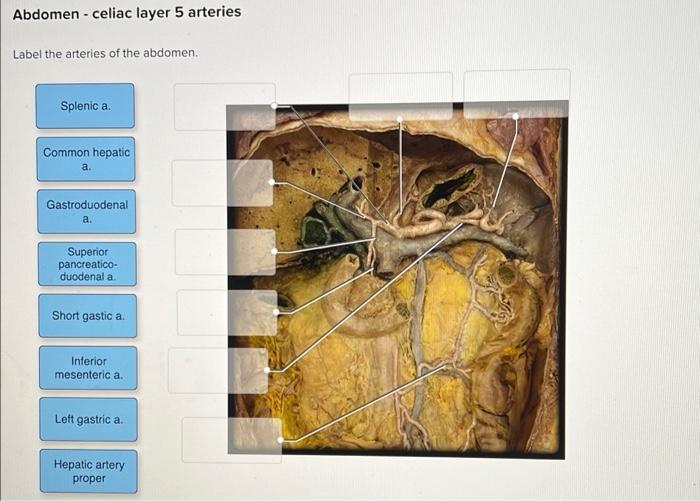 Solved Abdomen - celiac layer 5 arteries Label the arteries | Chegg.com