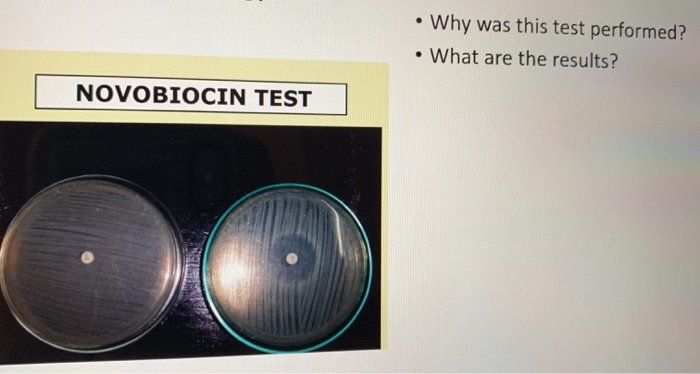 Solved Novobiocin susceptibility test was performed on the | Chegg.com