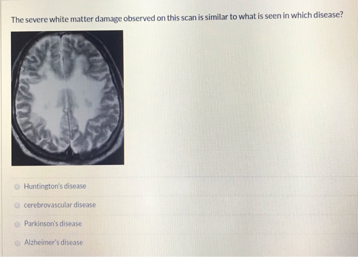 Solved The severe white matter damage observed on this scan | Chegg.com