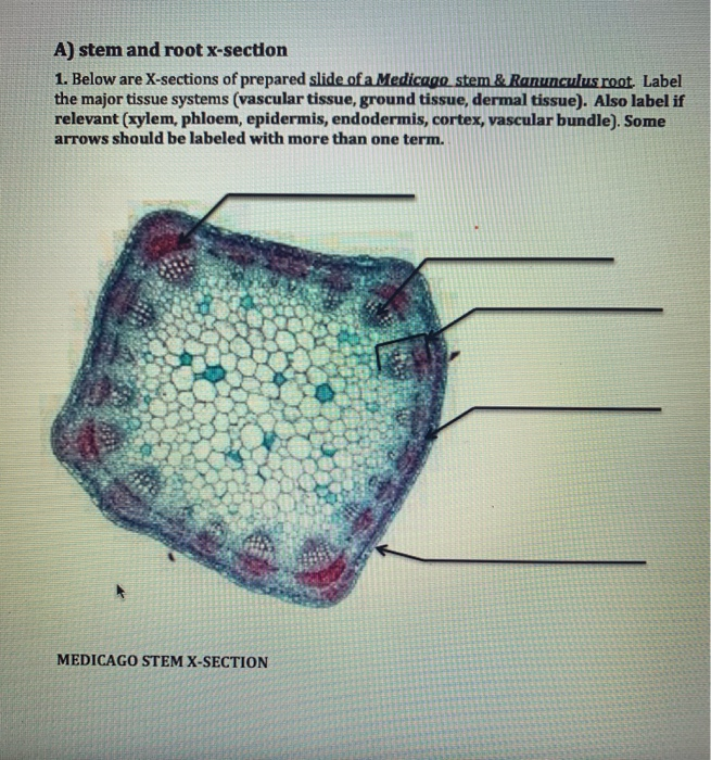 Solved A) stem and root x-section 1. Below are X-sections of | Chegg.com