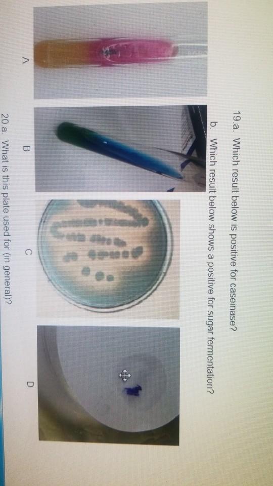 Solved 19.a. Which result below is positive for caseinase? | Chegg.com