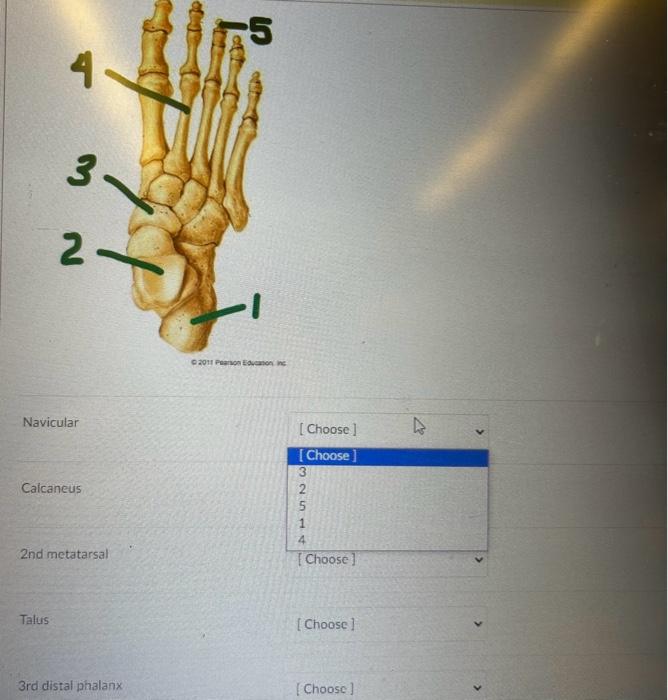 Solved Navicular Caicaneus 2nd metatarsal Talus 3rd distal | Chegg.com